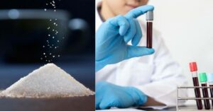 What To Eat Before A Glucose Test - 5 Things To Keep In Mind!