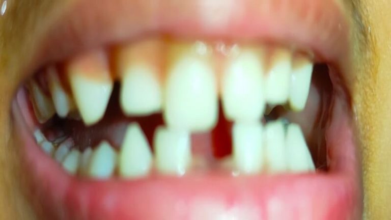 When Their Child Lose First Baby Teeth - A Complete Guide