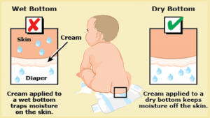 What Is Diaper Rash And How To Get Rid Of It?