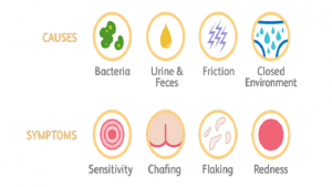 What Is Diaper Rash And How To Get Rid Of It?