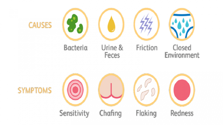 What Is Diaper Rash And How To Get Rid Of It?